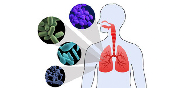 Lung Microbiota: A new way forward for future treatments? - SAFETY Project